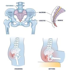12 Best Stretches for Tailbone Pain Relief and Improved Mobility ...